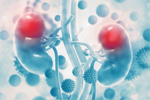 Cum trebuie tratate tumorile rinichiului | replicaonline.ro