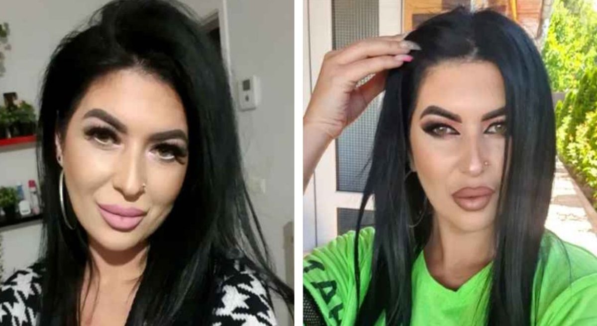 Româncă moartă după operații estetice făcute în Turcia. Copilul ei a ...