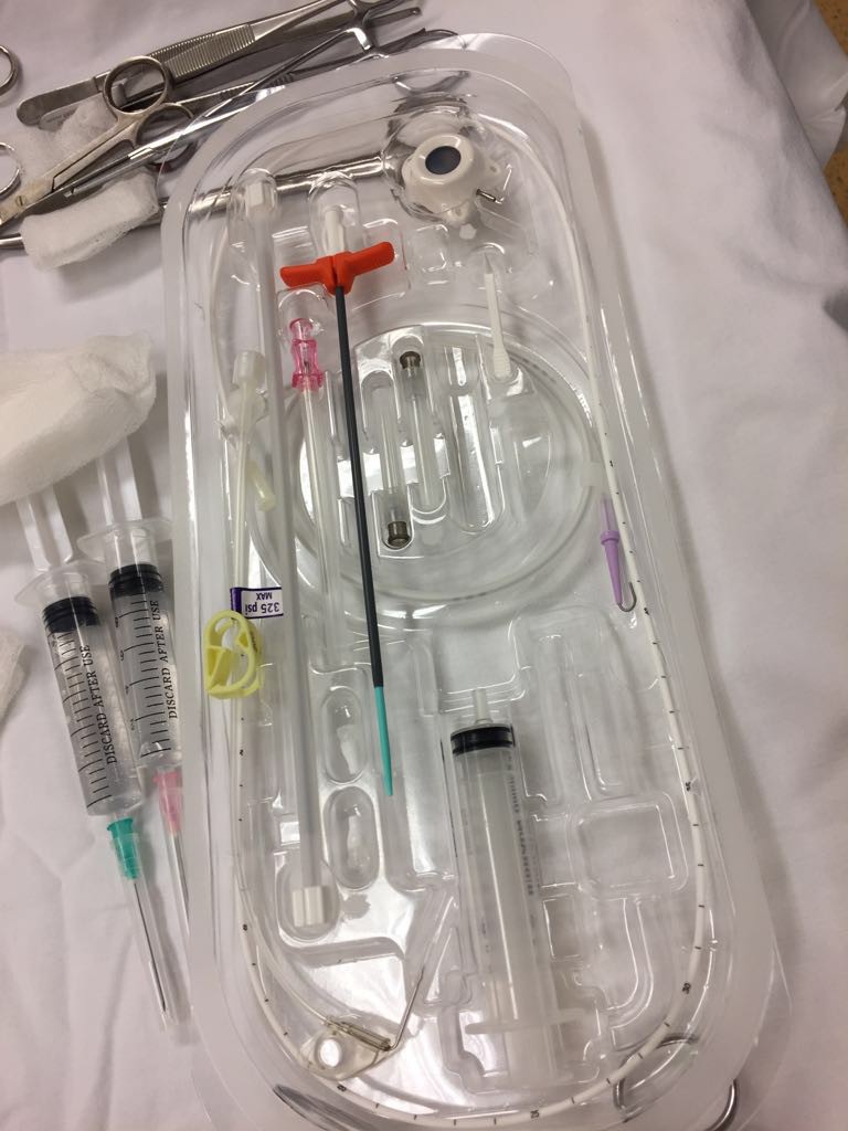 Cameră pentru citostatice, implantată subcutanat bolnavilor de cancer ...