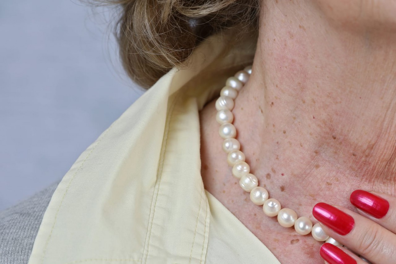 Papiloamele și verucile: simptome, cauze și tratament | replicaonline.ro