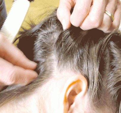 Păduchii merg la şcoală, după vacanţa de vară | replicaonline.ro